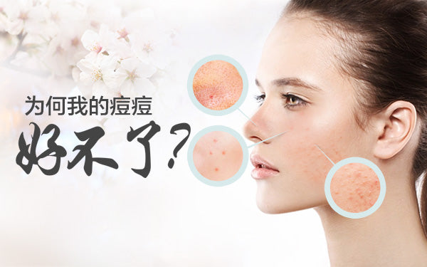 Acne / Blemish Skin - Axioma Cosmeceutical